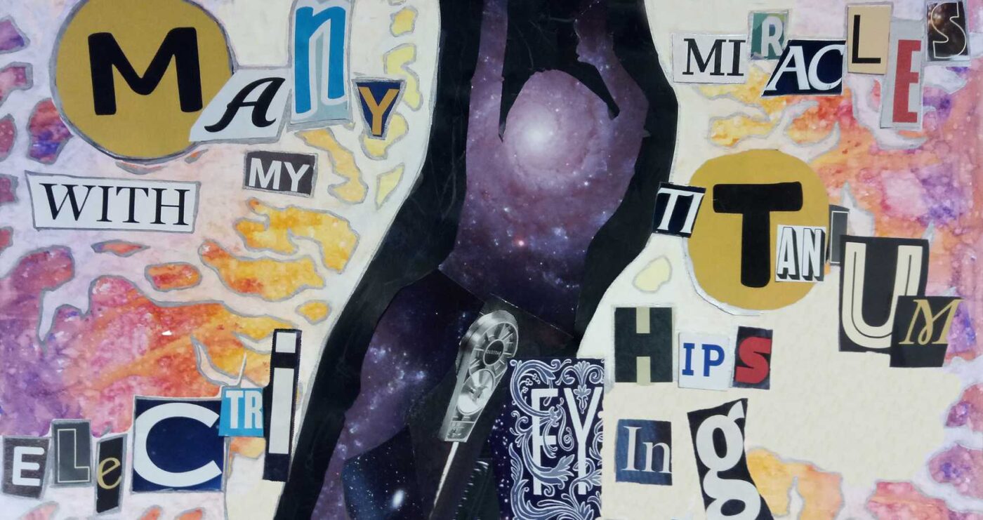 Titanium Hip Miracles by Robyn MacKinnon at Spillwords.com